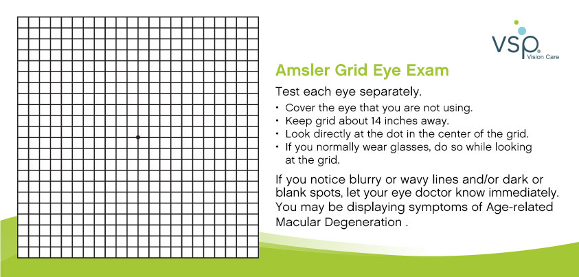 Test Yourself with the Amsler Grid Eye Exam - Motherhood Support
